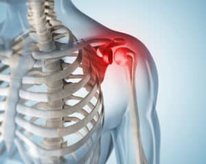 5 Easy Exercises To Help With Frozen Shoulder Release - Release Works ...